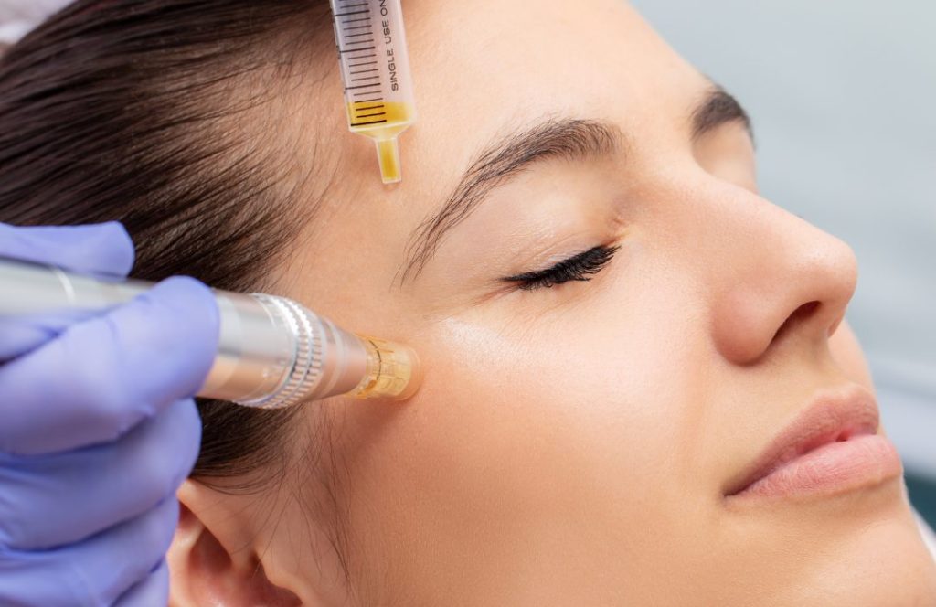 Micro Channeling | Regenerative Medicine Center - Dr. Valerie Donaldson ...